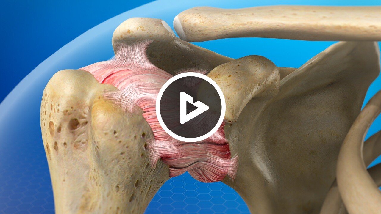 Frozen Shoulder (Adhesive Capsulitis) - Shoulder - Willis Knighton ...